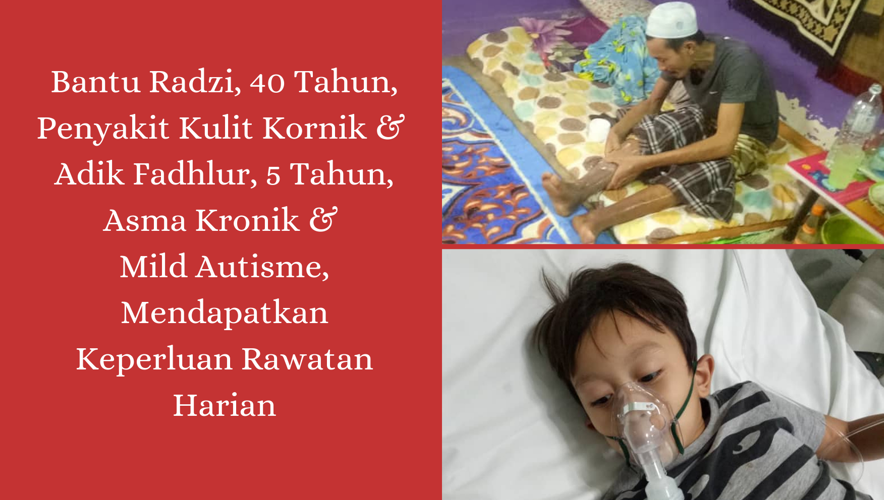 Bantu Radzi, 40 Tahun, Penyakit Kulit Kronik & Adik Fadhlur, 5 Tahun ...