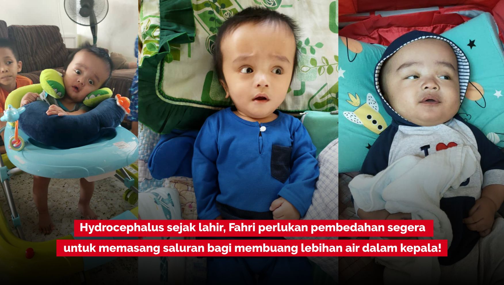 Jom Bantu Biaya Kos Pembedahan Aqeef Fahri